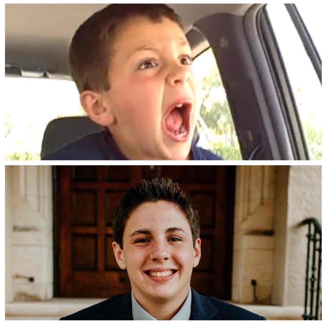 Cameo - David After Dentist